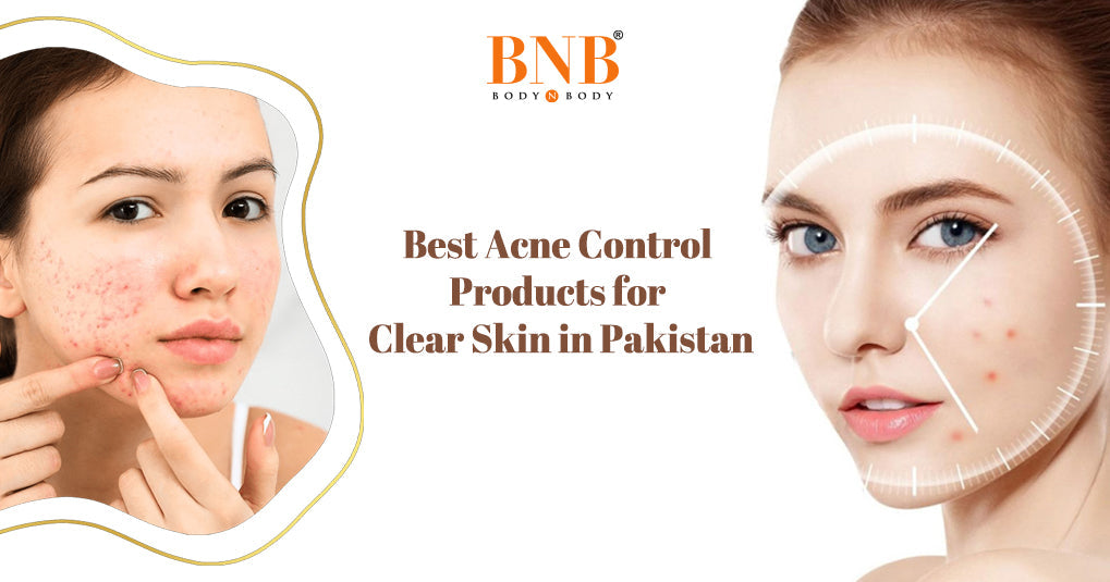 Best Acne Control Products for Clear Skin in Pakistan