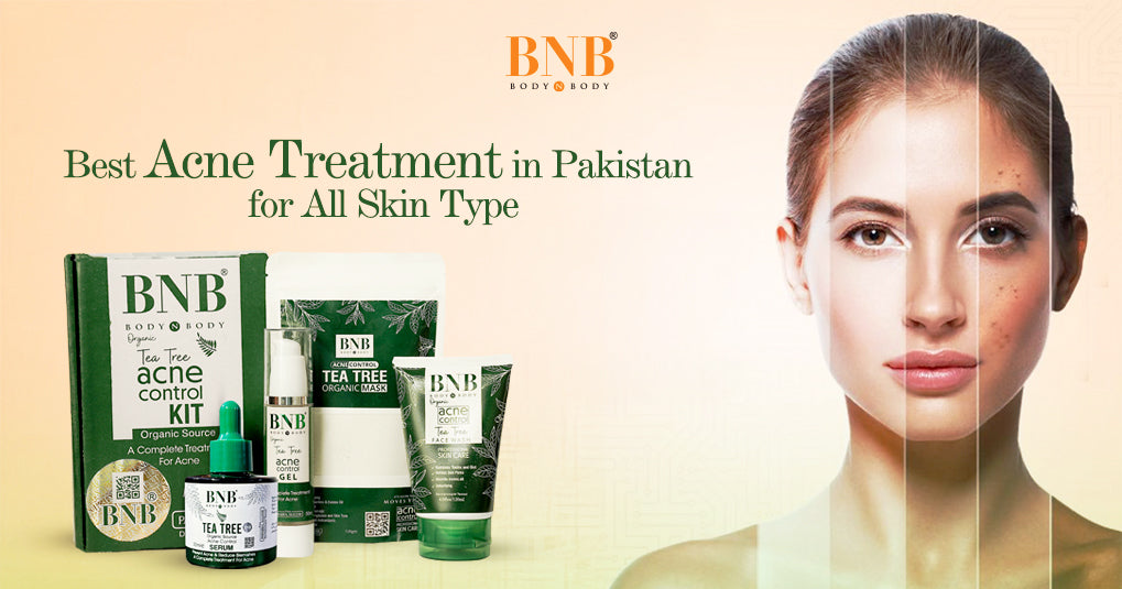 Best Acne Treatment in Pakistan for All Skin Type